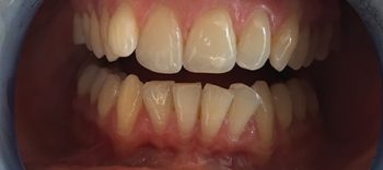 Narrow Arches - Smile Rooms